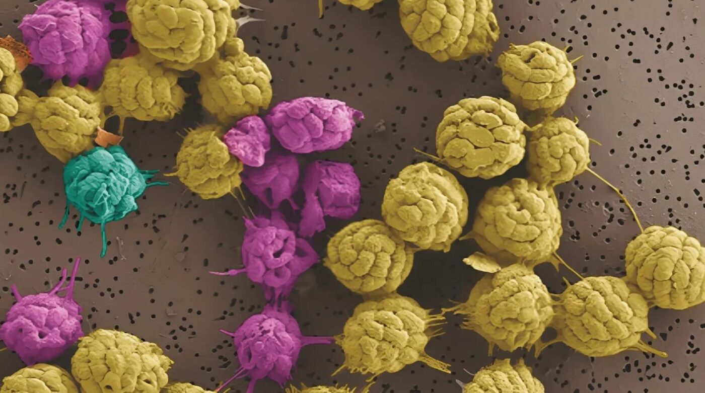 Уникальные бактерии, которые не могут жить поодиночке, проливают свет ...